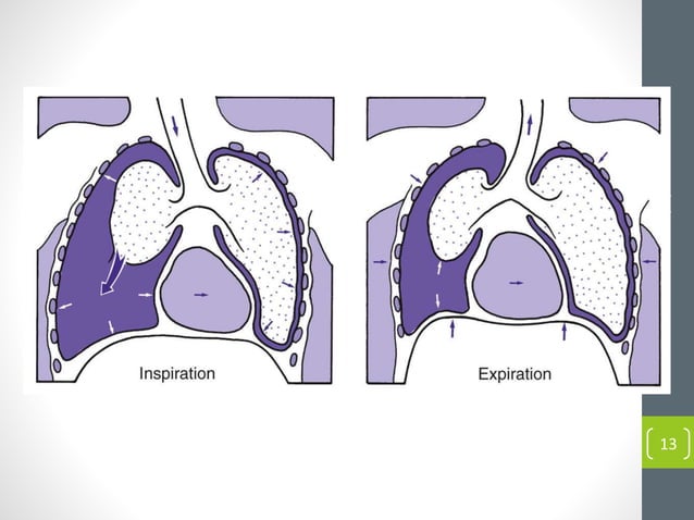 Pneumothorax | PPT