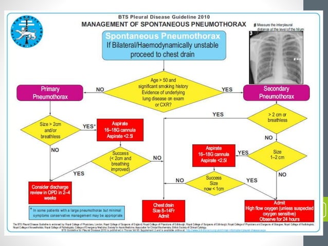 Pneumothorax | PPT