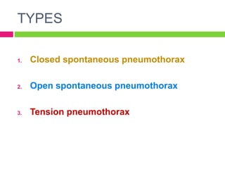 Pneumothorax | PPTX