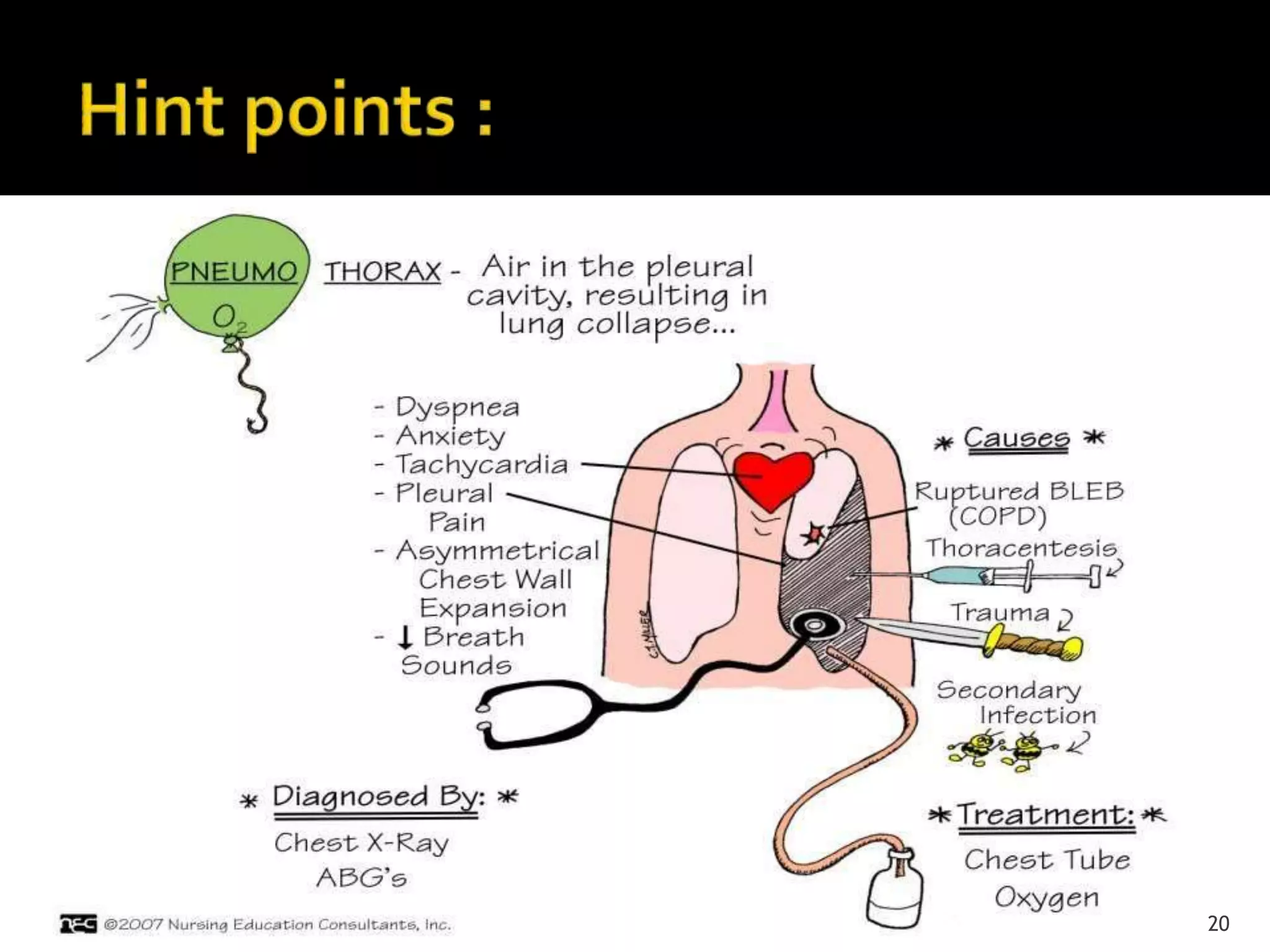 Pneumothorax 141221114833 Conversion Gate02 Pptx