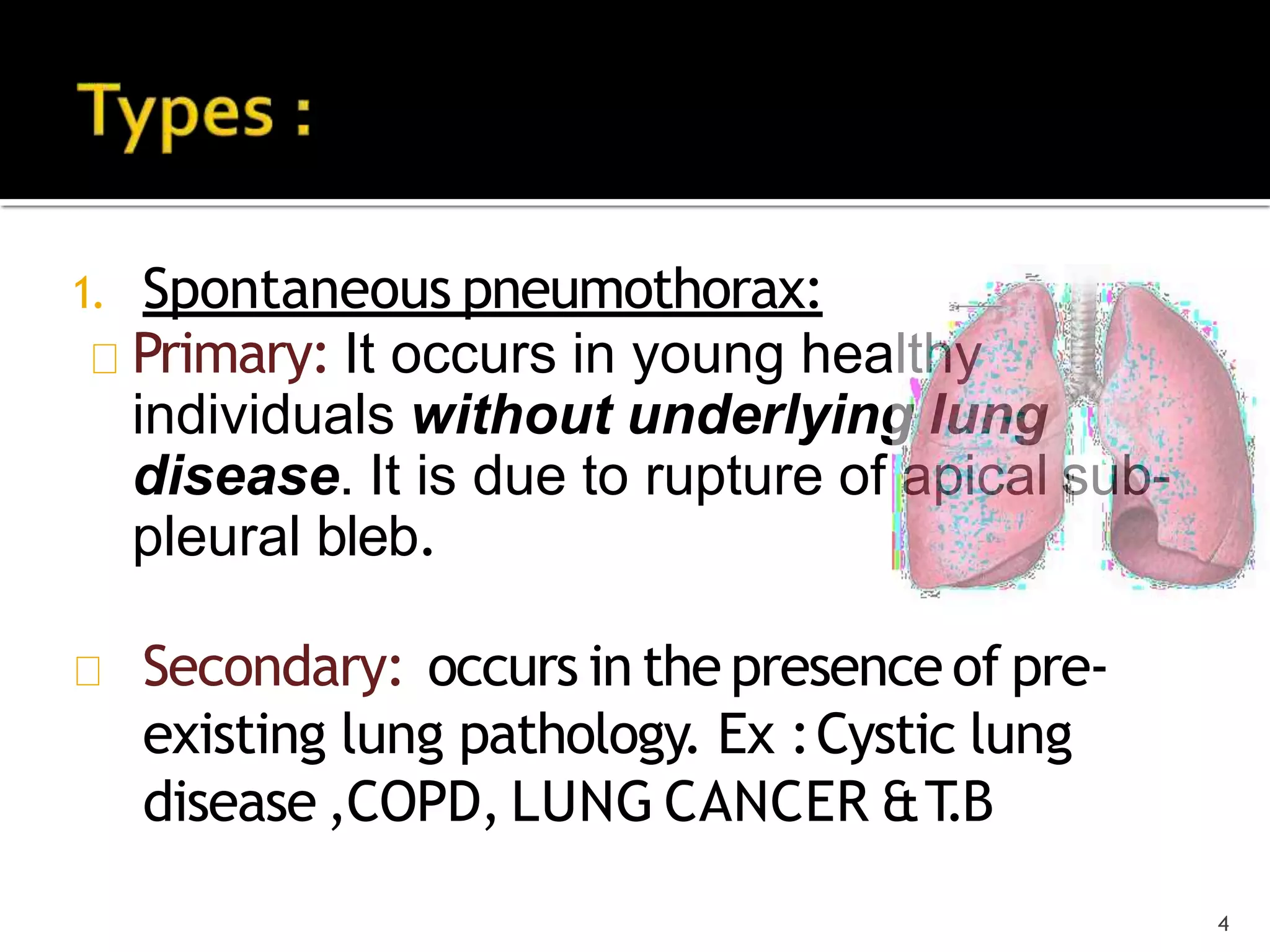 Pneumothorax 141221114833 Conversion Gate02 Pptx