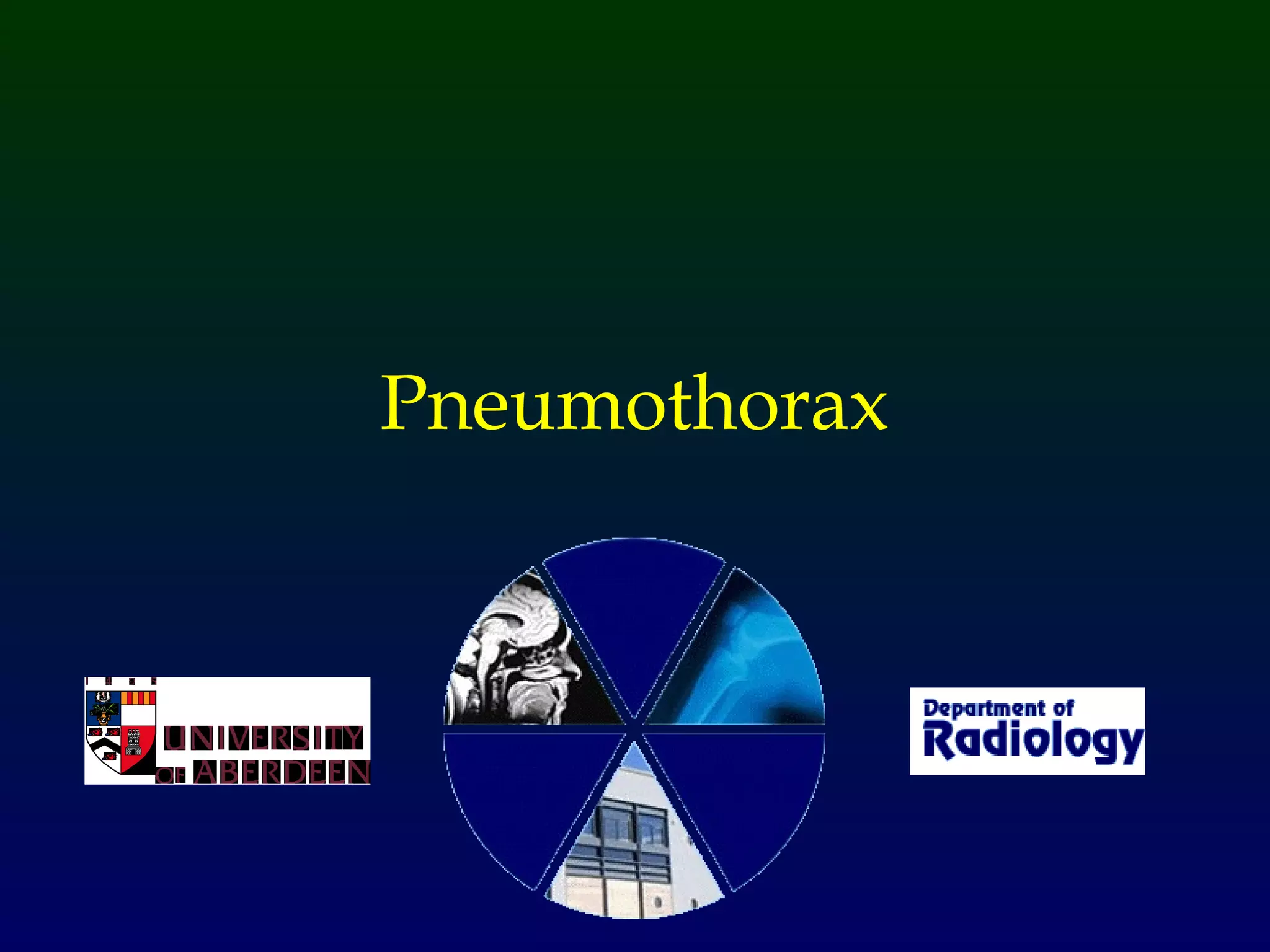 Pneumothorax | PPT