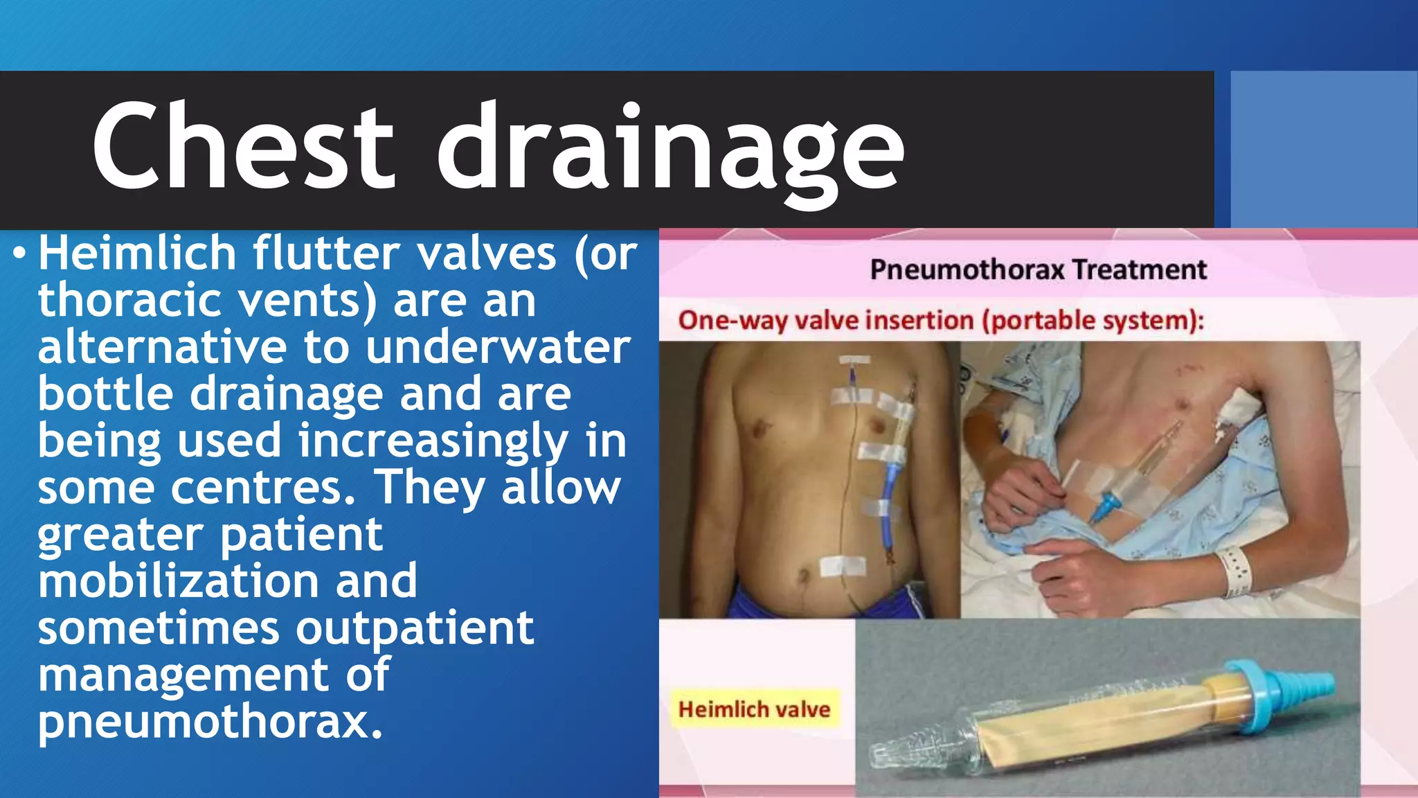Pneumothorax by Dr. Sookun Rajeev Kumar | PPTX