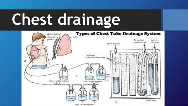 Pneumothorax by Dr. Sookun Rajeev Kumar