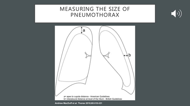 Pneumothorax | PPTX | Lung and Respiratory Health | Diseases and Conditions