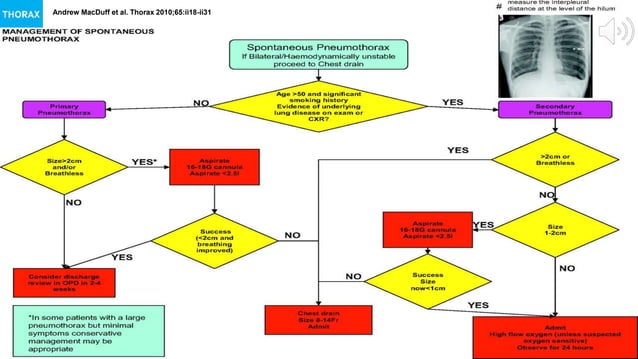 Pneumothorax | PPTX | Lung and Respiratory Health | Diseases and Conditions