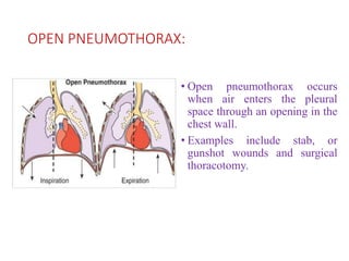 Pneumothorax & Haemothorax | PPTX