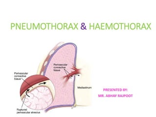 Picture Pneumothorax Hemothorax