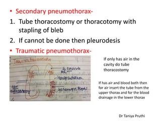 Pneumothorax | PPTX