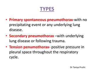 Pneumothorax | PPTX