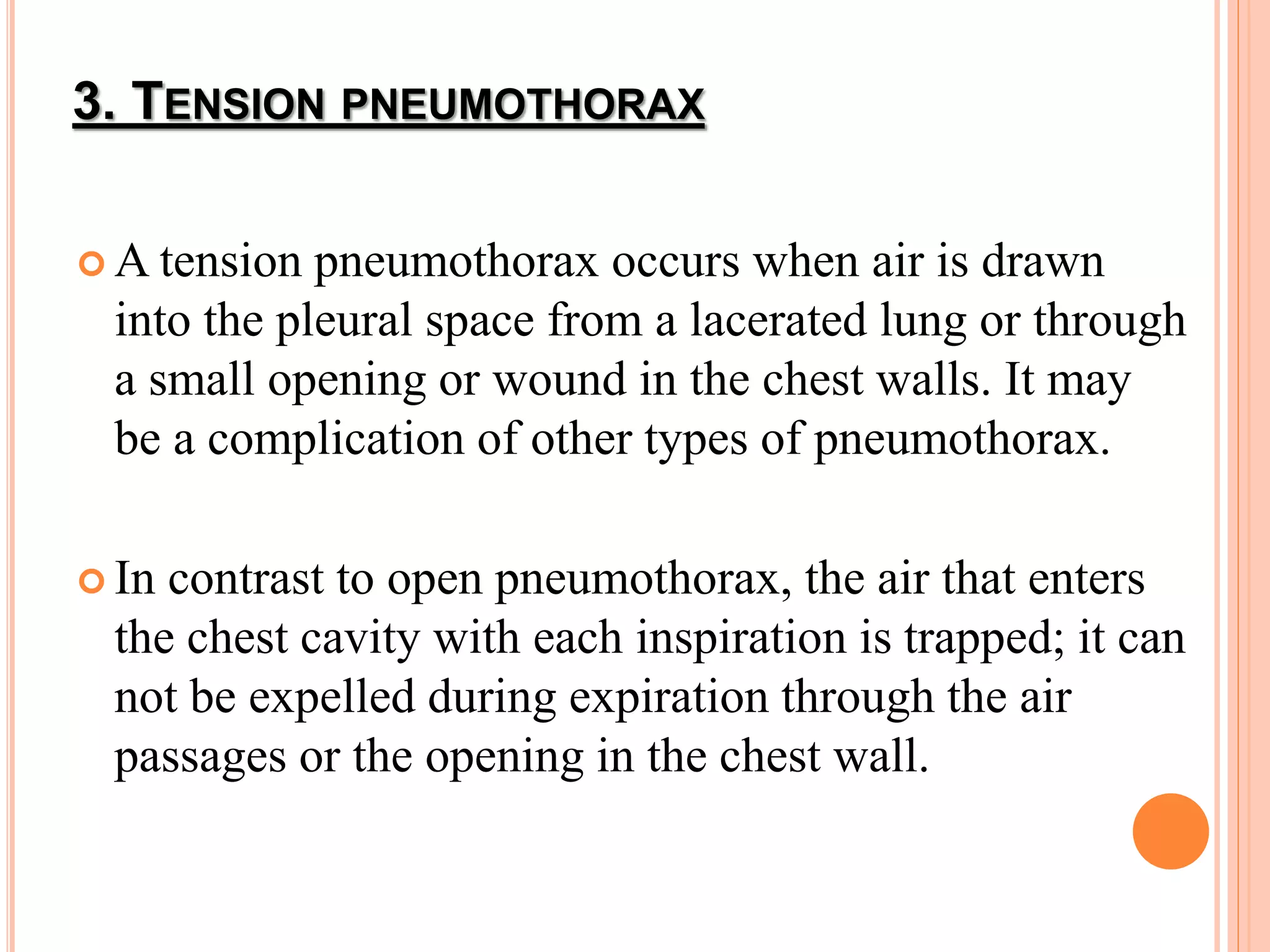 Pneumothorax | PPTX