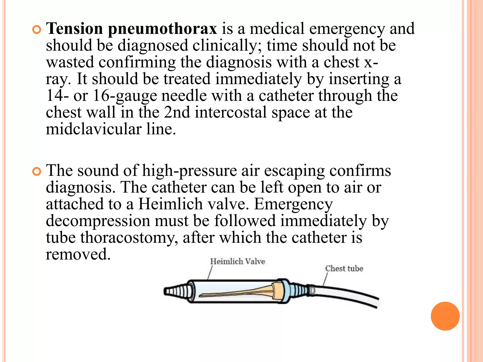 Pneumothorax | PPTX