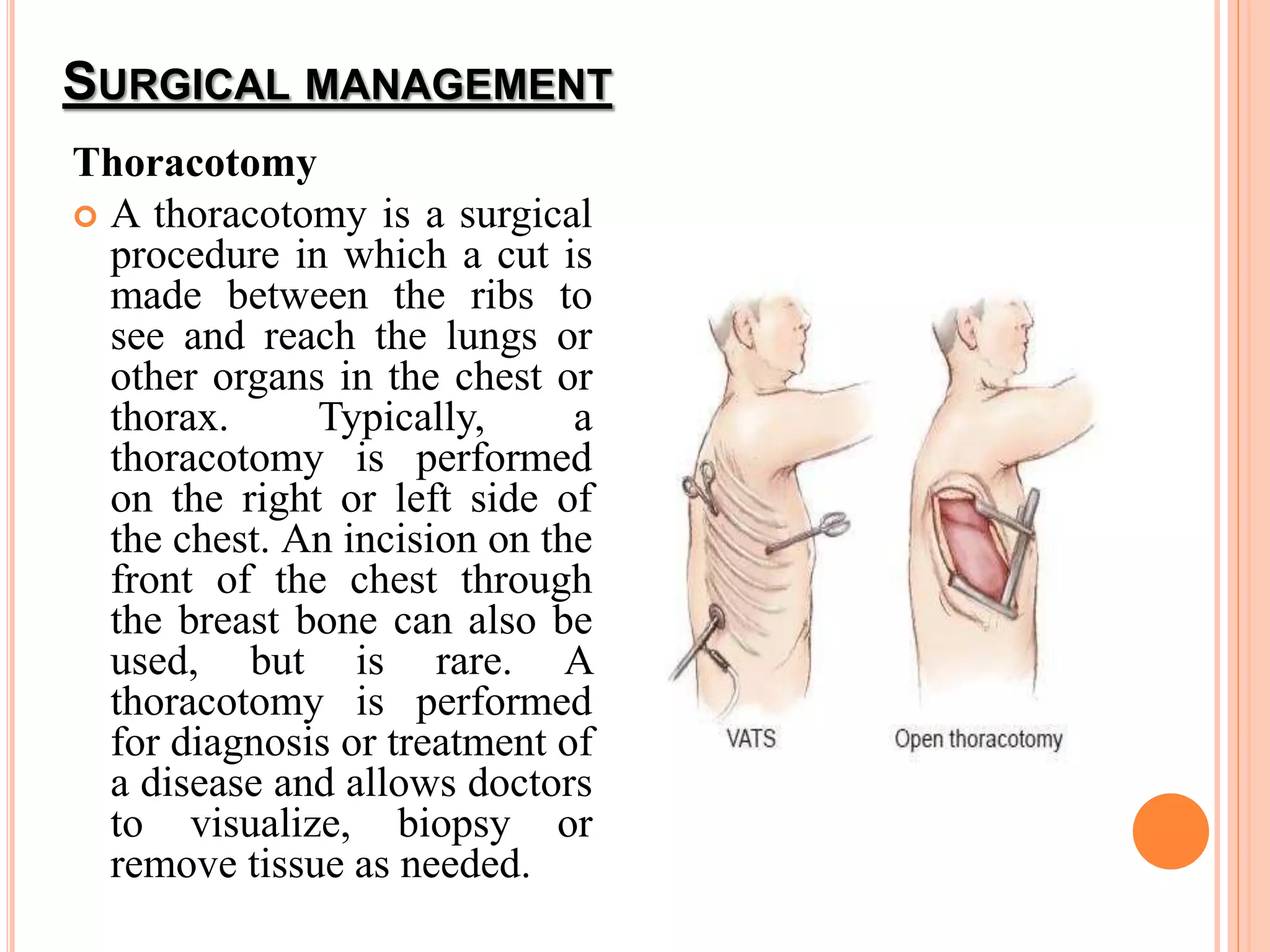 Pneumothorax | PPTX