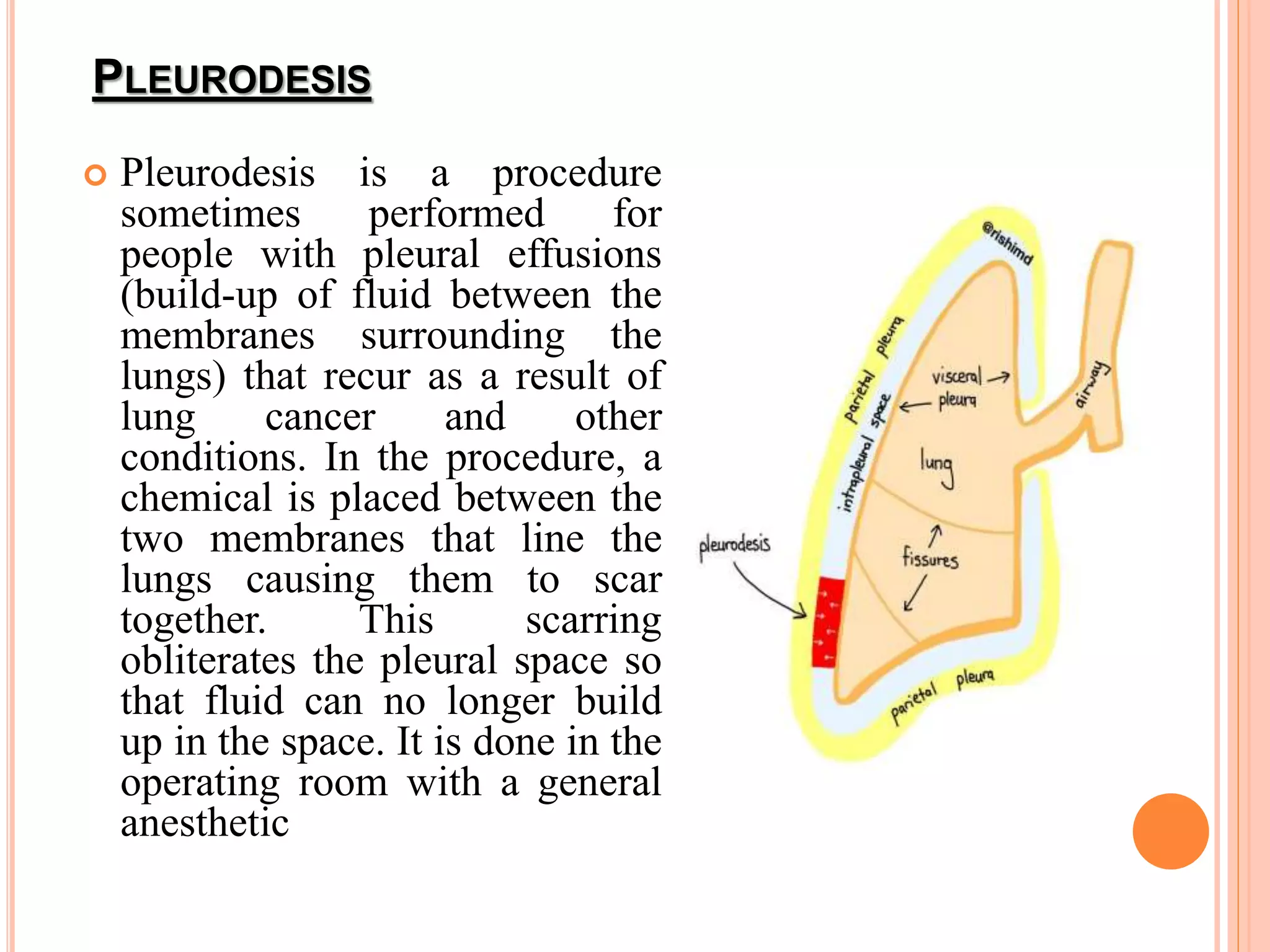 Pneumothorax Pptx
