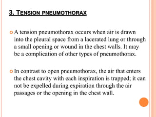 Pneumothorax | PPTX