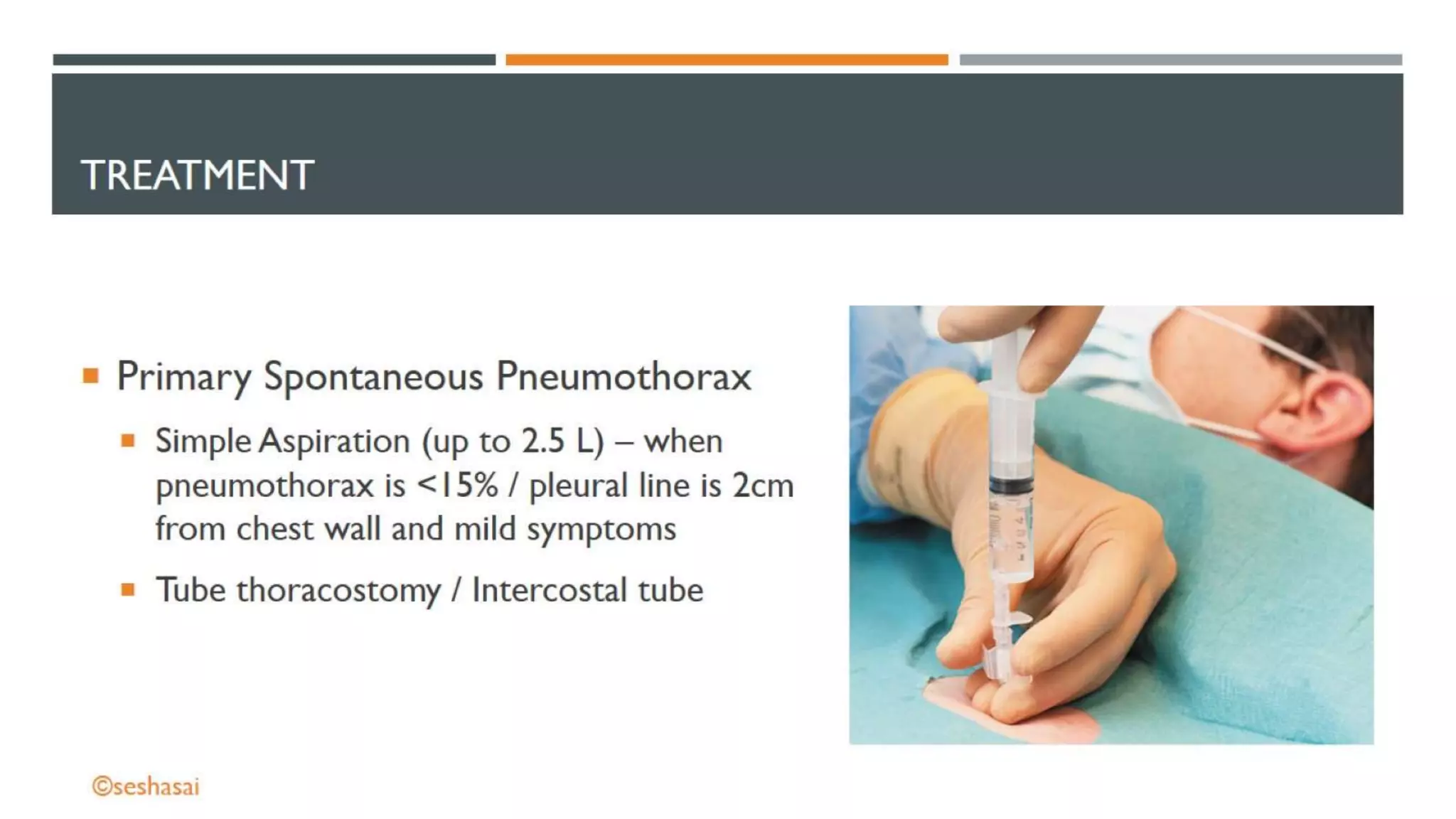 Pneumothorax for Undergraduates | PPTX | Lung and Respiratory Health ...