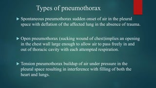 Pneumothorax | PPTX
