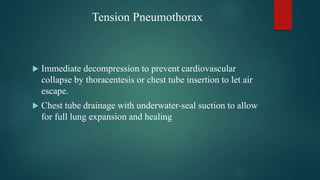 Pneumothorax | PPTX