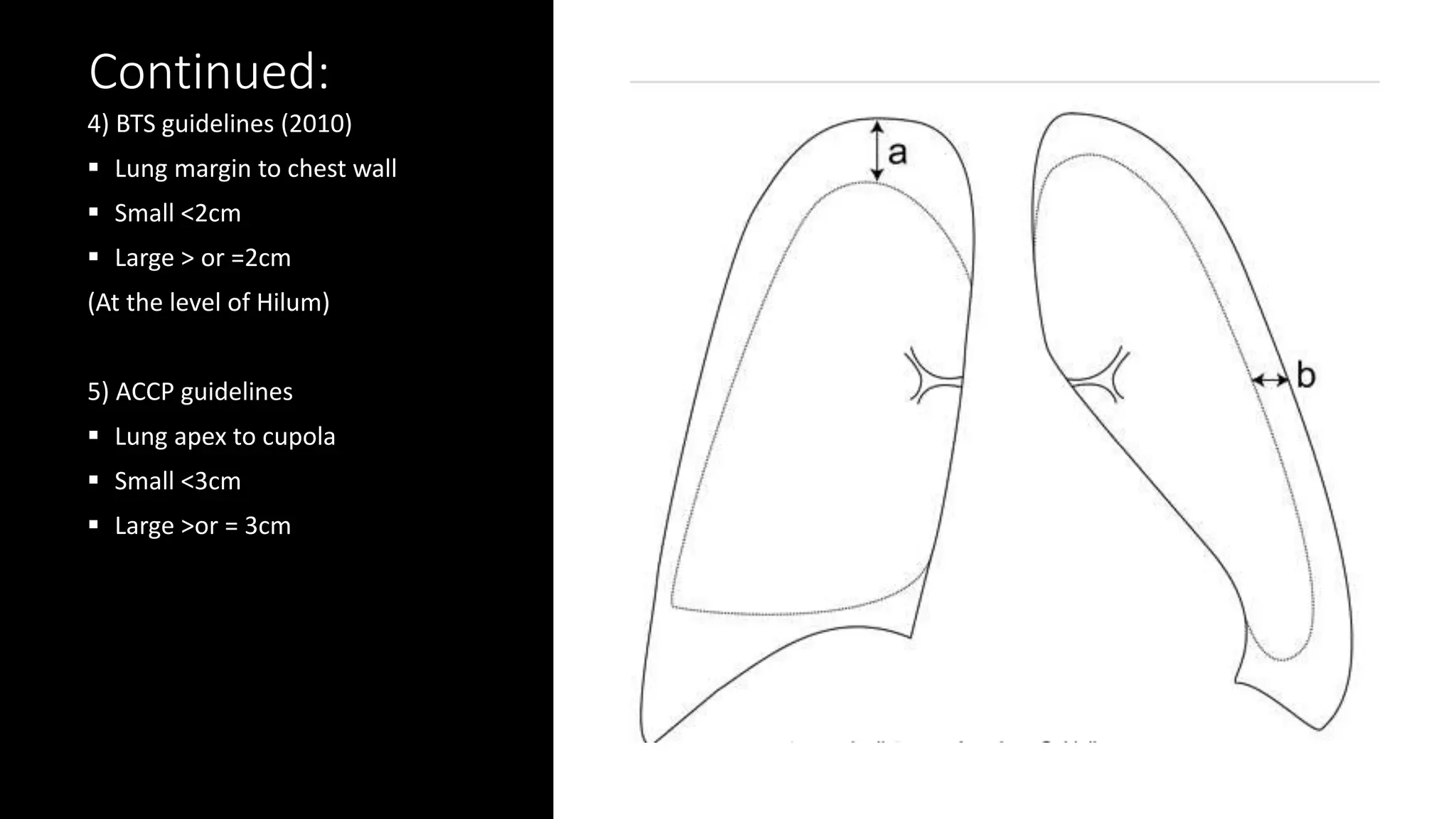 Pneumothorax | PPTX