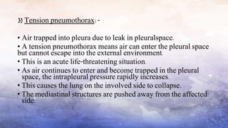 Pneumothorax.HR