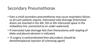 Pneumothorax | PPTX