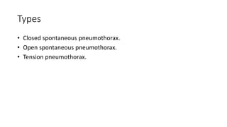 Pneumothorax | PPTX