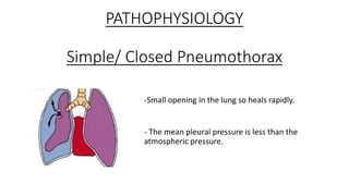 Pneumothorax | PPTX