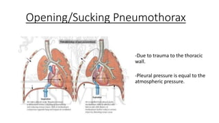 Pneumothorax | PPTX