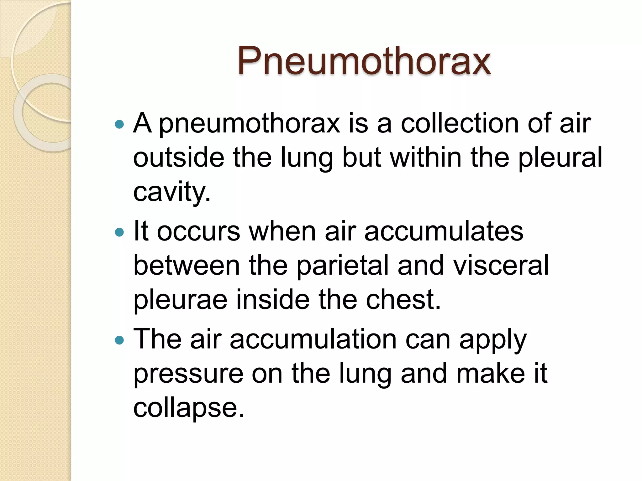 Pneumothorax.pptx