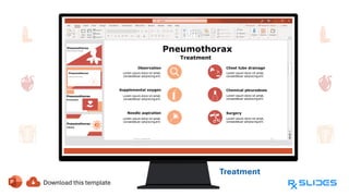 pneumothorax | PDF