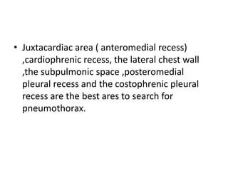 pneumothorax-ppt.pptx