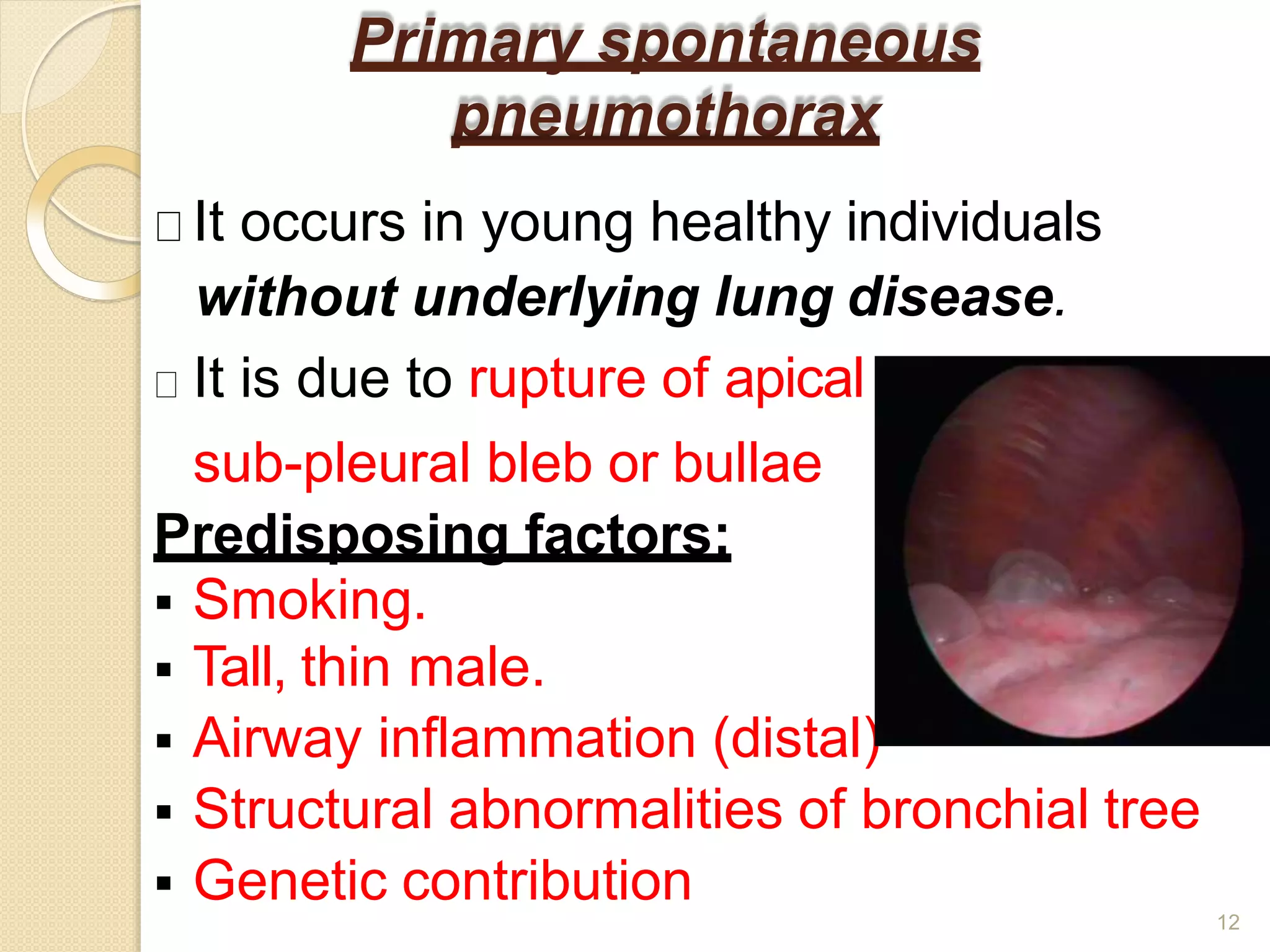 Pneumothorax-surgical emergency.pptx