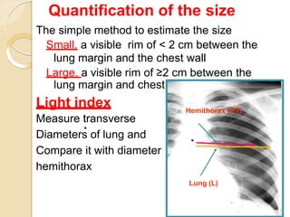 Pneumothorax-surgical emergency.pptx