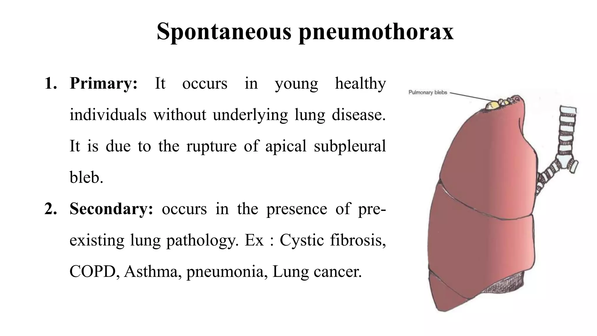 PNEUMOTHORAX_075811.pptx