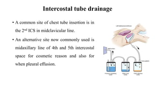 PNEUMOTHORAX_075811.pptx