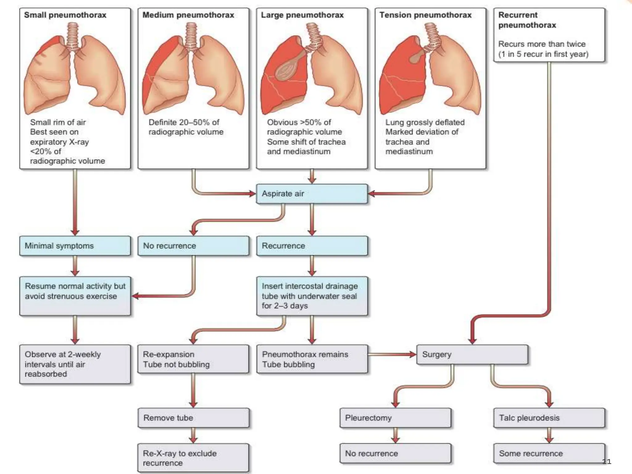 pneumothorax 1.pptx definition, types, clinical features, diagnosis ...