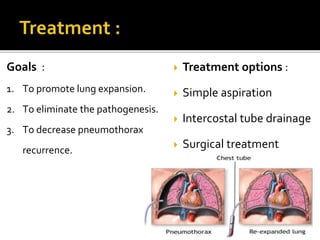 pneumothorax 1.pptx definition, types, clinical features, diagnosis ...