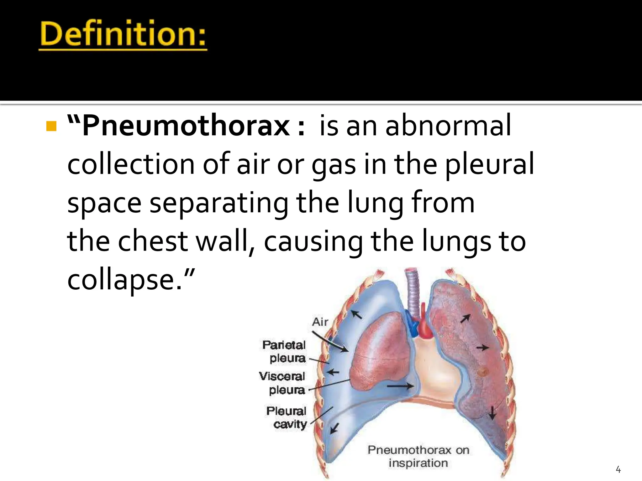 pneumothorax 1.pptx definition, types, clinical features, diagnosis ...