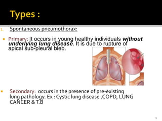 pneumothorax 1.pptx definition, types, clinical features, diagnosis ...