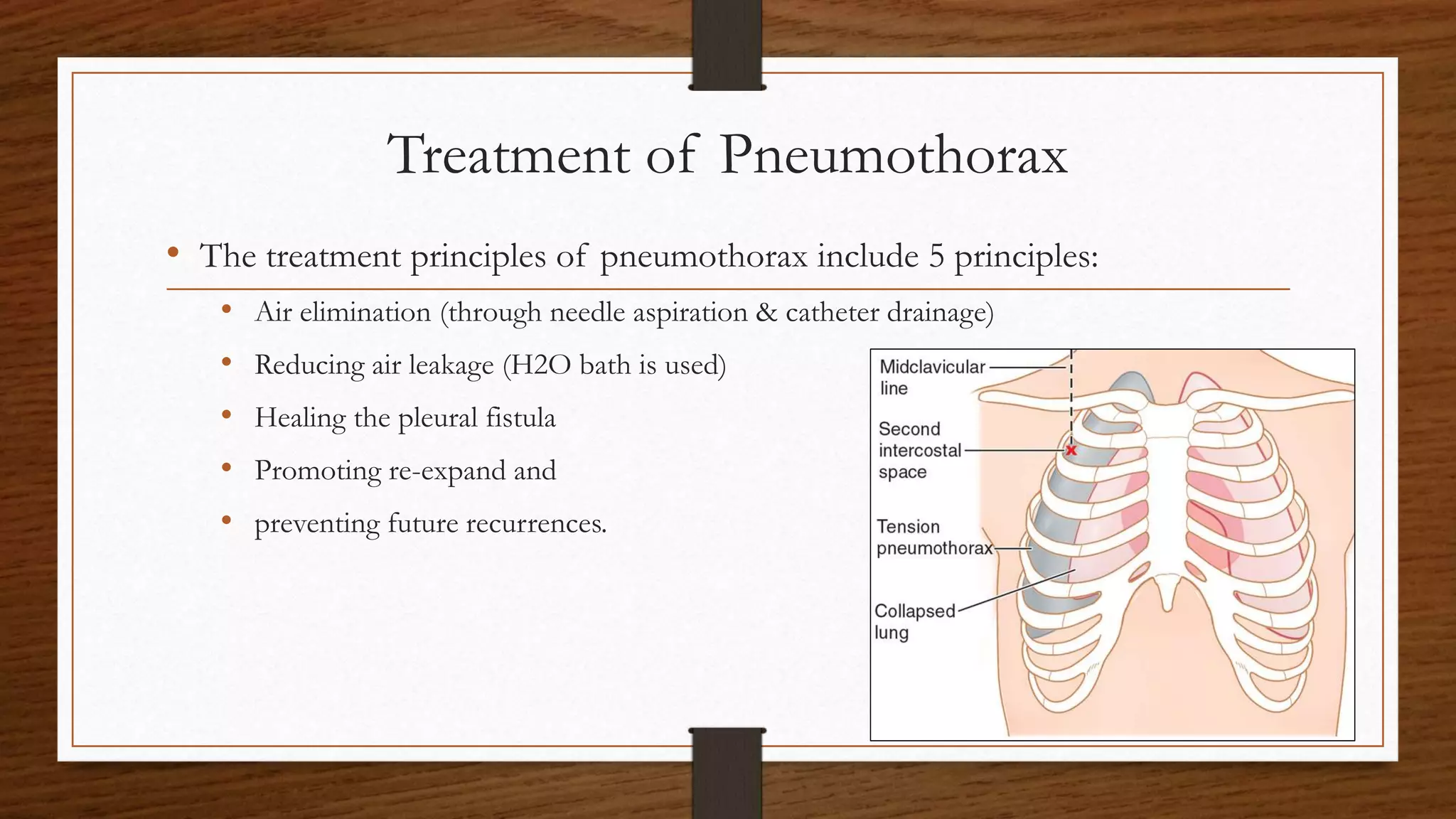 Pneumothorax ABC Assessment | PPTX