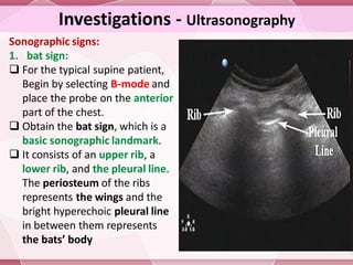 Pneumothoraxandpneumomediastinum 160830234614 (1) | PPT