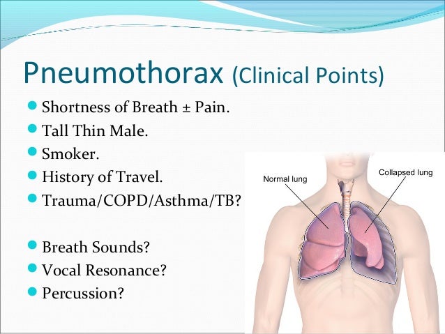 Pneumothorax & chest tube final year mbbs lecture