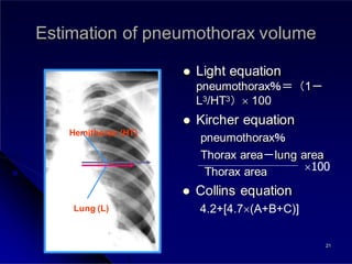 pneumothorax (medical topic) for surgeons | PDF