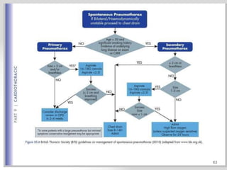 pneumothorax (medical topic) for surgeons | PDF