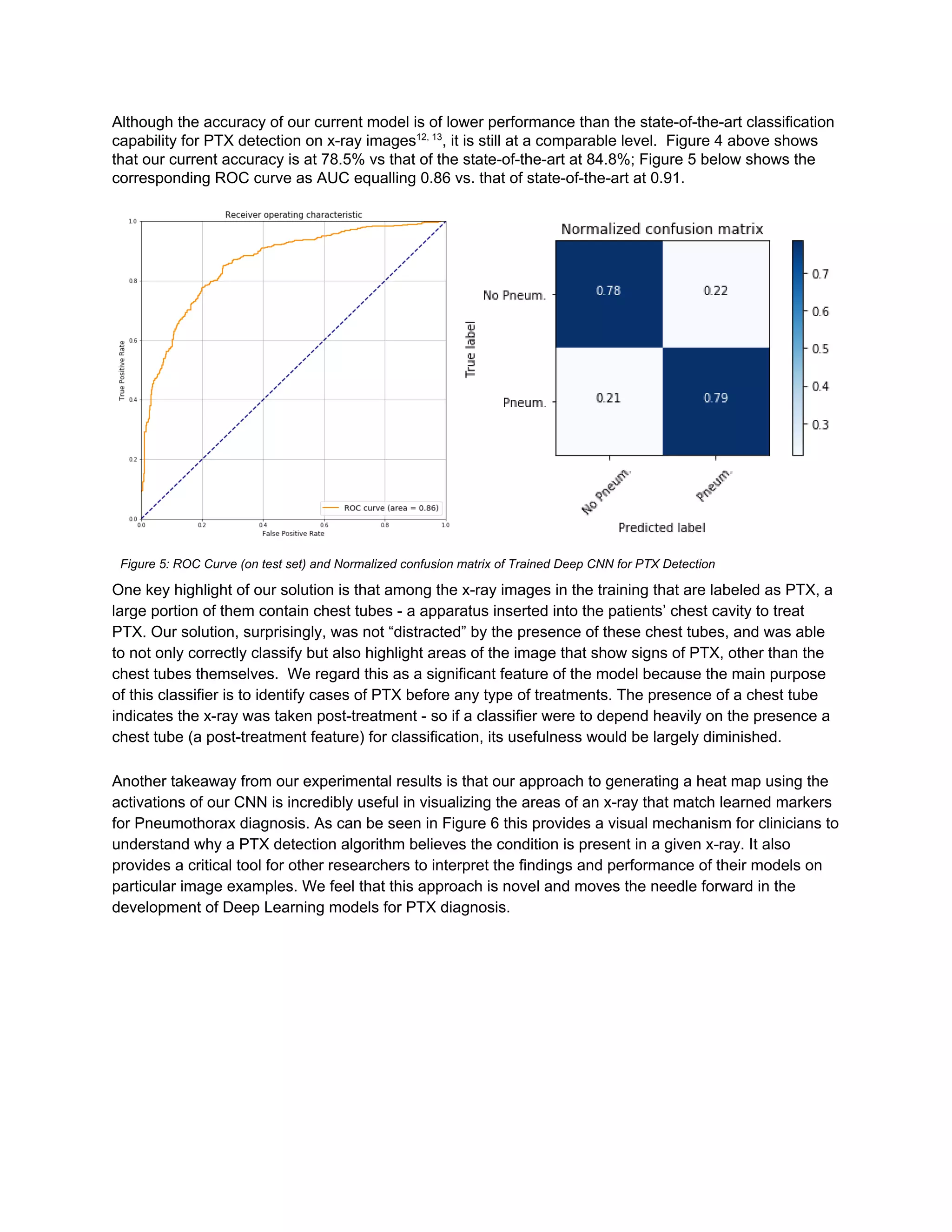 Pneumothorax Detection Using Deep Convolutional Neural Networks | PDF