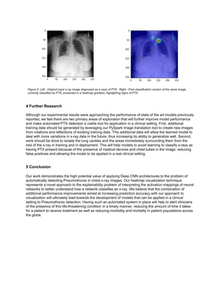 Pneumothorax Detection Using Deep Convolutional Neural Networks | PDF