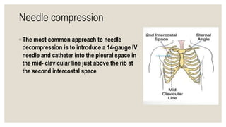 PNEUMOTHORAX Forensic Medicine.pptx