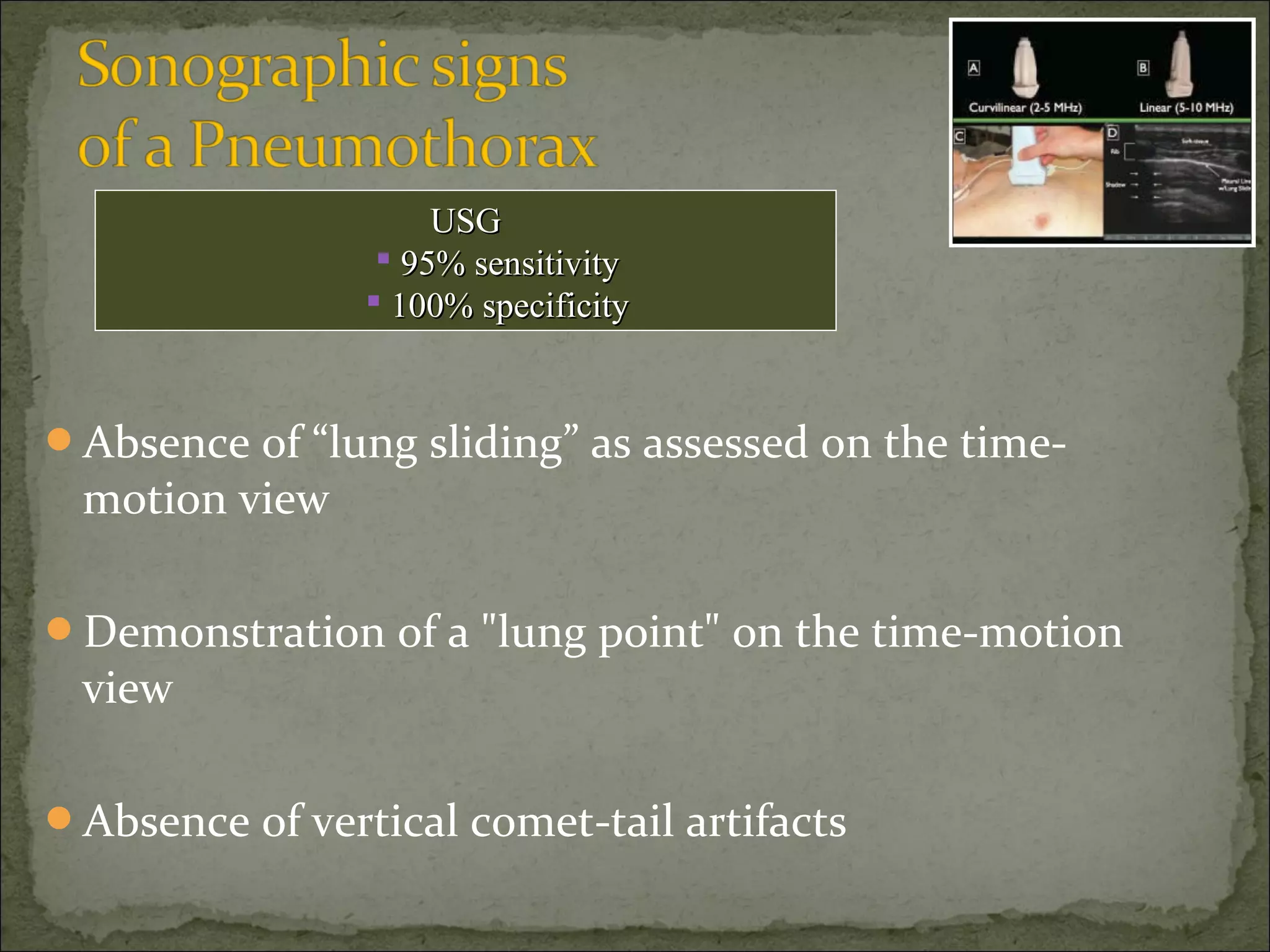 Pneumothorax class | PPT