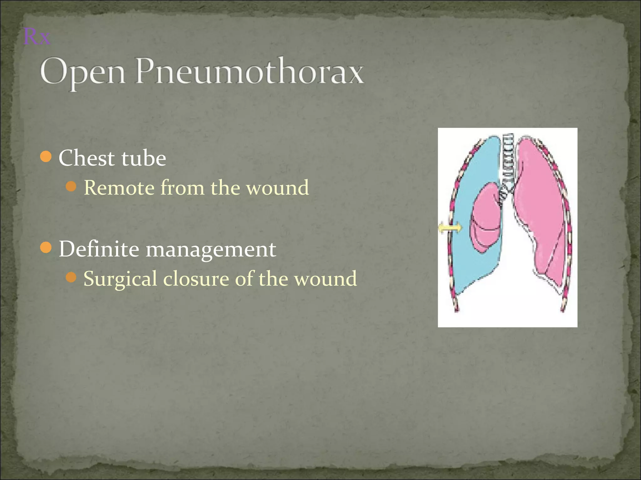 Pneumothorax class | PPT