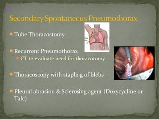 Pneumothorax class | PPT